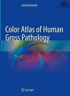 خرید و قیمت Color Atlas of Human Gross Pathology | ترب